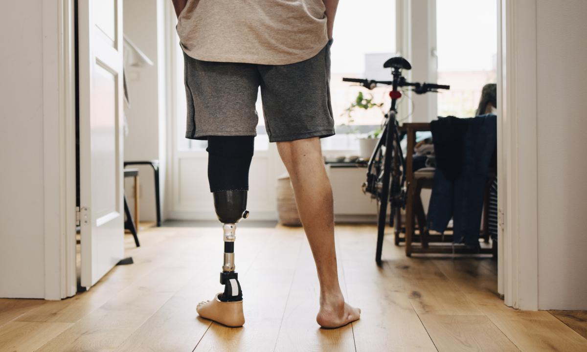 Un colombiano residente en España con una prótesis en la pierna escucha ...