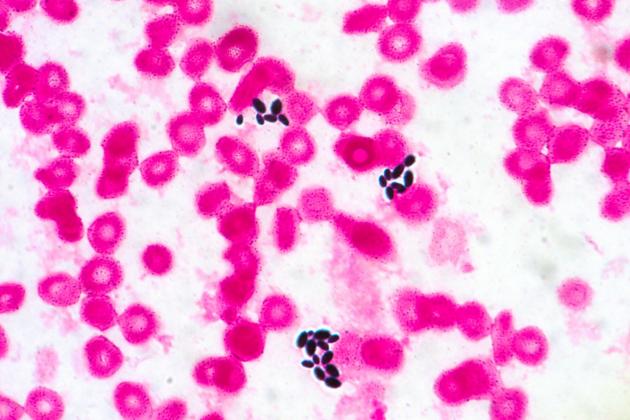 Candida parapsilosis: qué es, síntomas y tratamiento del hongo que se ...