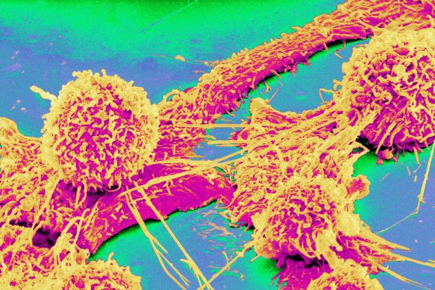 La medicina está muy cerca del motivo de la explosión del cáncer de ...