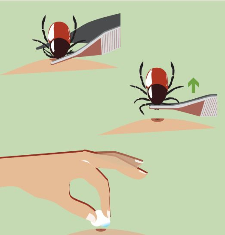 El manual de emergencia de Sanidad para actuar de inmediato frente a la ...