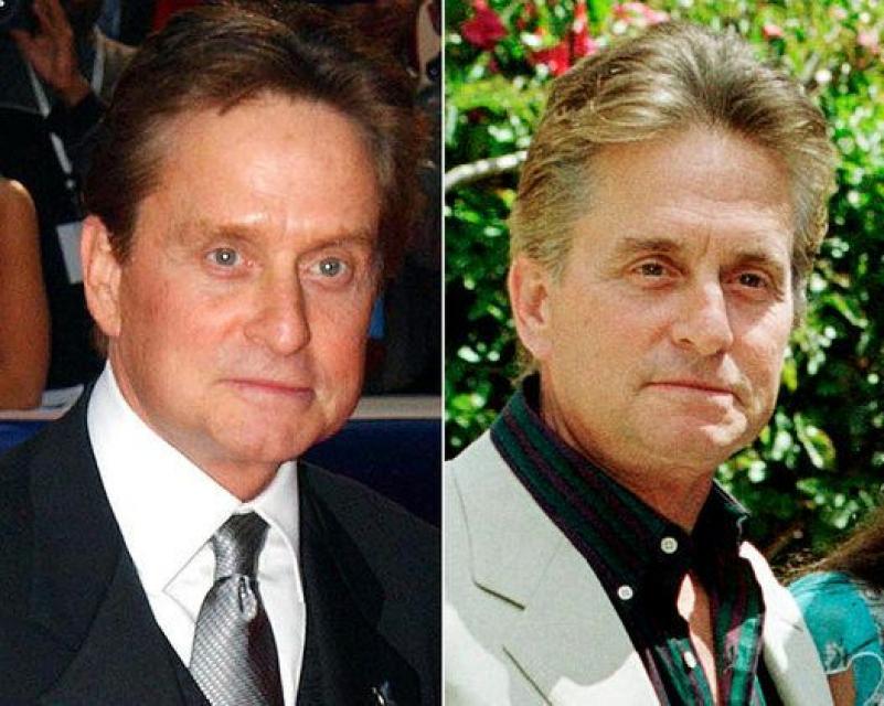 Actores operados: ellos también pasan por el quirófano (FOTOS)