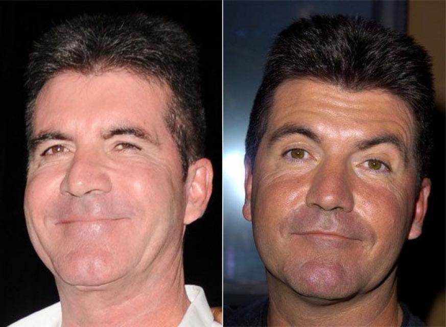 Actores operados: ellos también pasan por el quirófano (FOTOS)