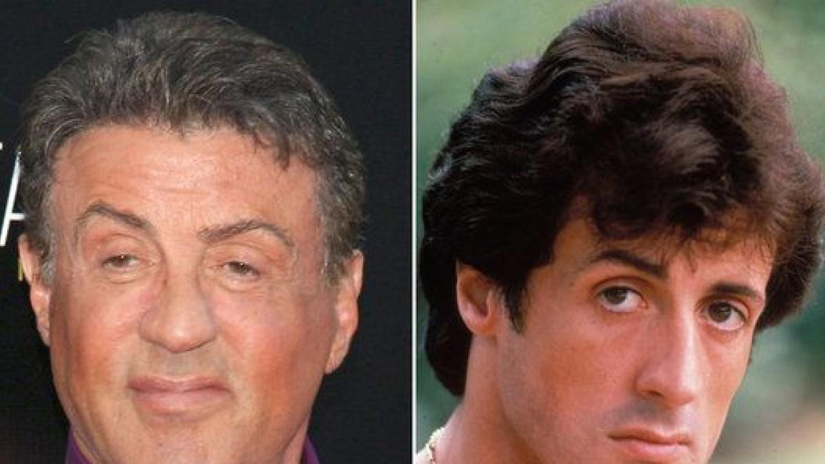 Actores operados: ellos también pasan por el quirófano (FOTOS)