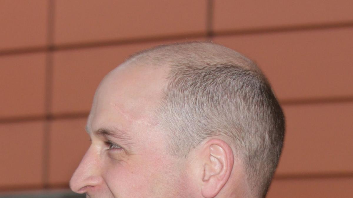 Cómo quedarte calvo con estilo