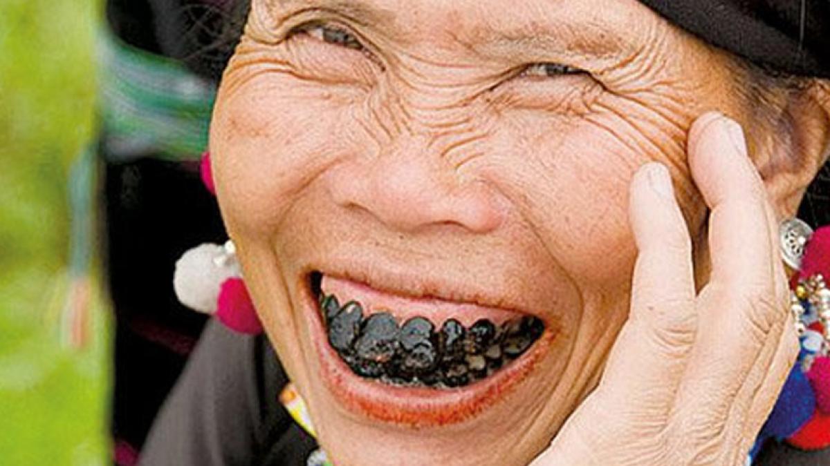 El único país del mundo en el que tener los dientes negros era símbolo ...