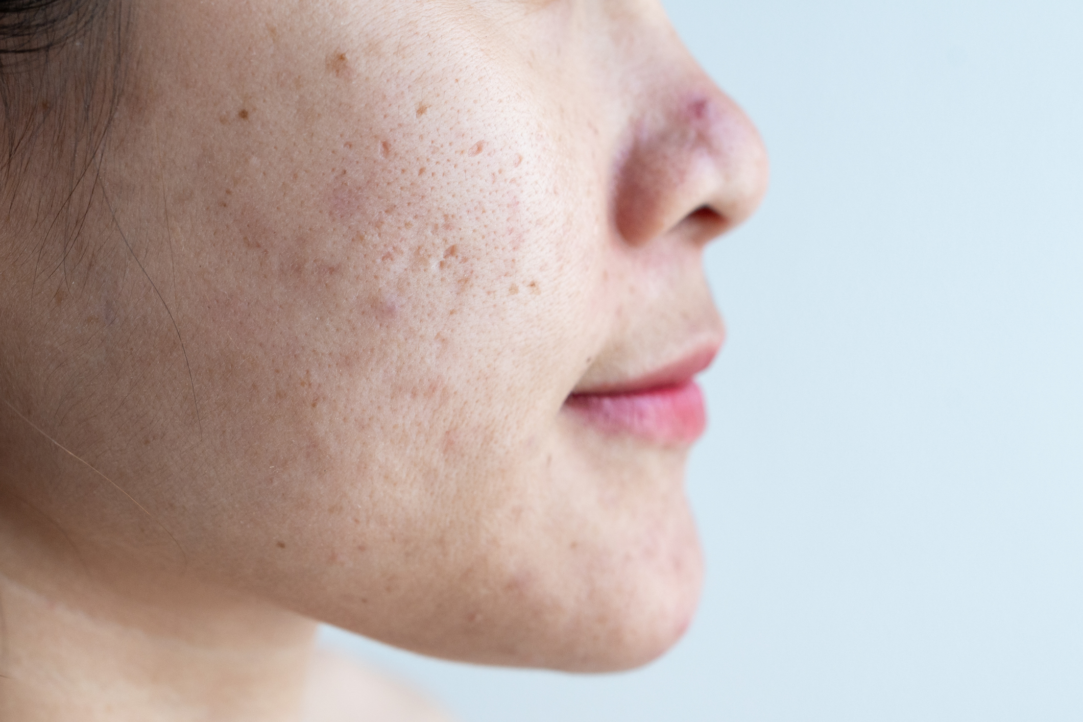 Cuatro alimentos deliciosos que previenen la aparición de manchas en la ...